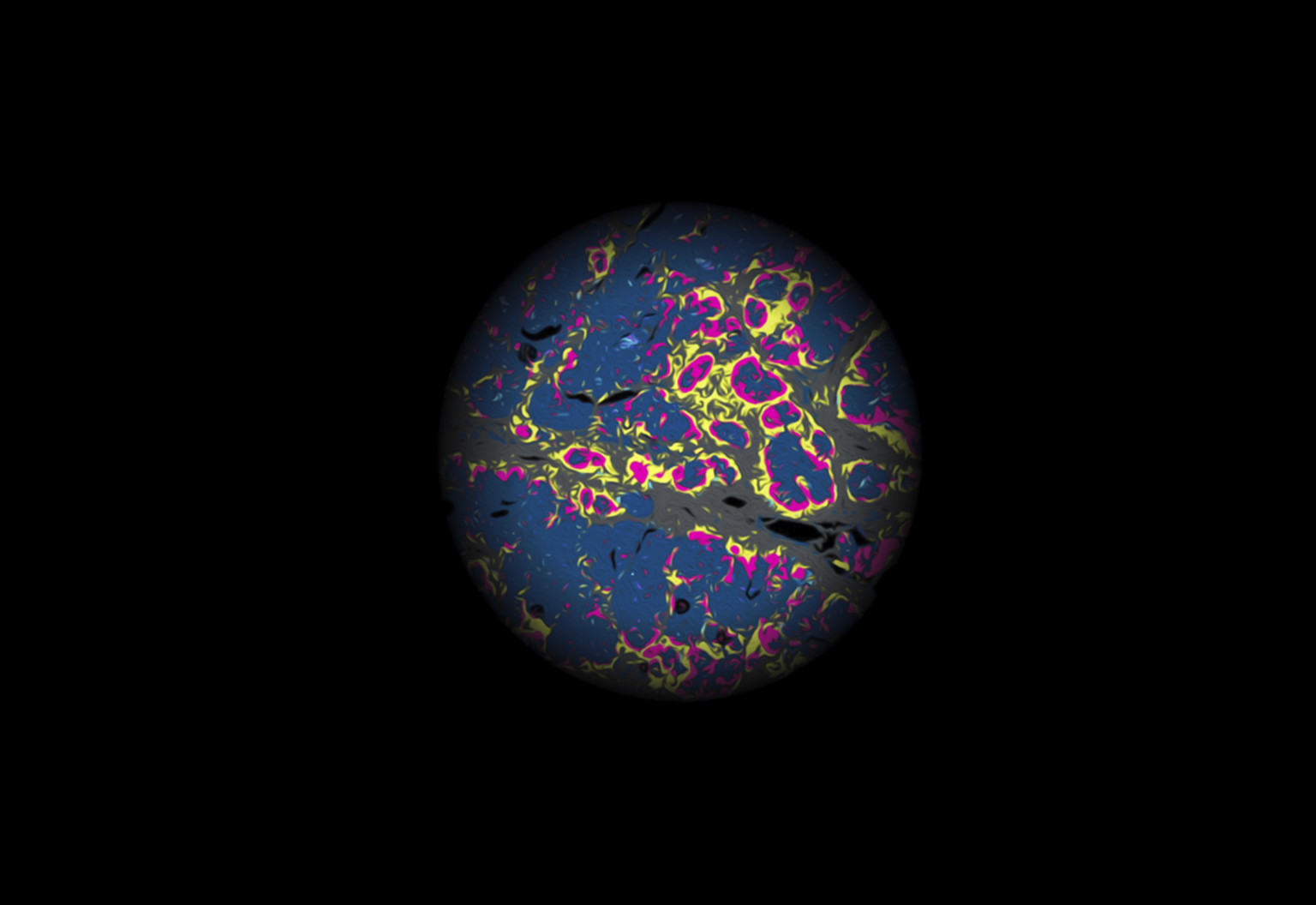 UNIGE leads breakthrough in understanding tumor growth