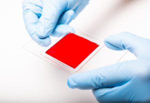 Strategic investment for Mimix's tissue regeneration treatment